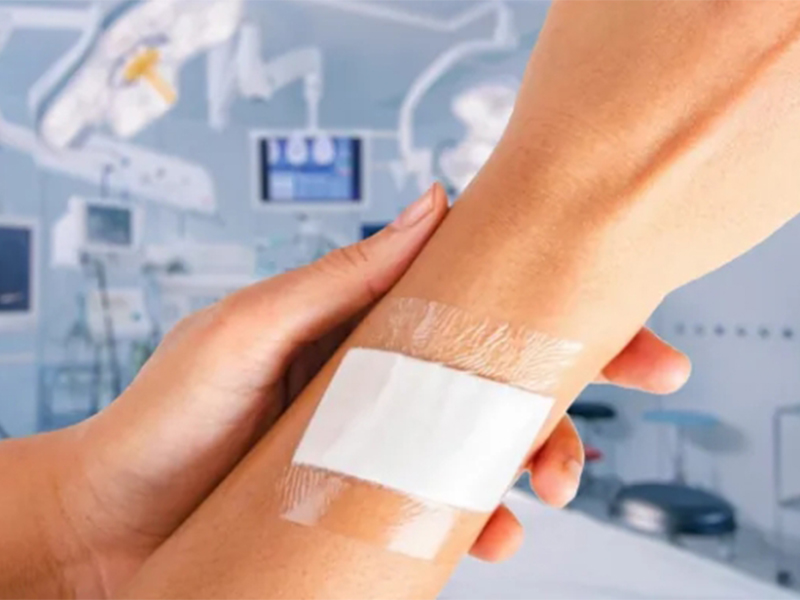 What Are the Common Issues and Solutions in Pressure-Sensitive Adhesive ...